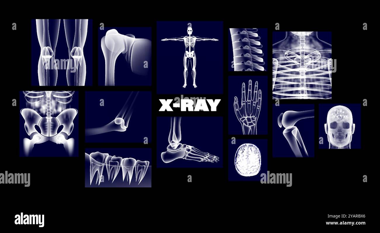 Arm arthritis Stock Vector Images - Alamy