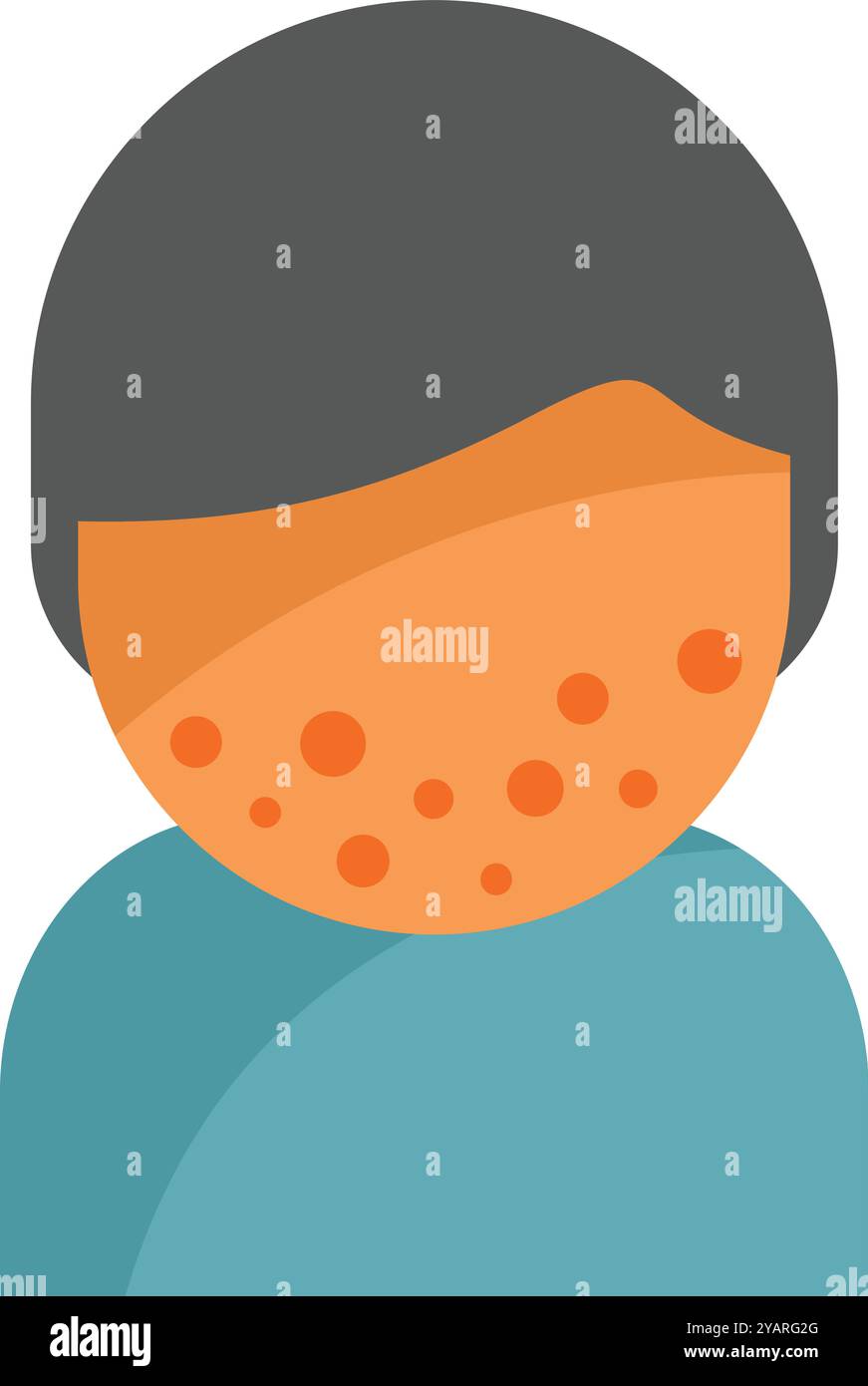 This vector illustration depicts a young man with an acne breakout on ...