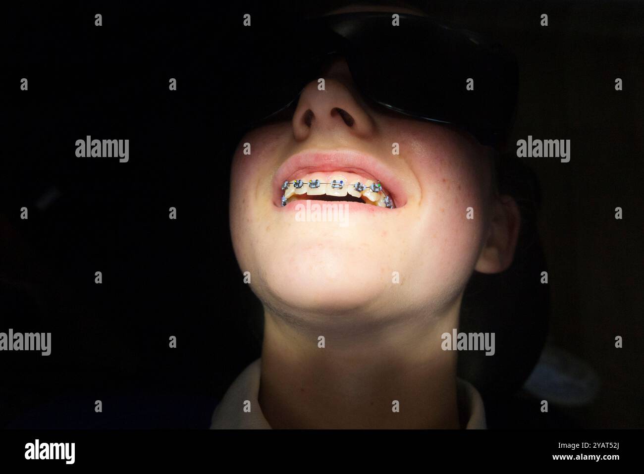 Young girl aged 12 years gets NHS brace, braces, fitted to her ...