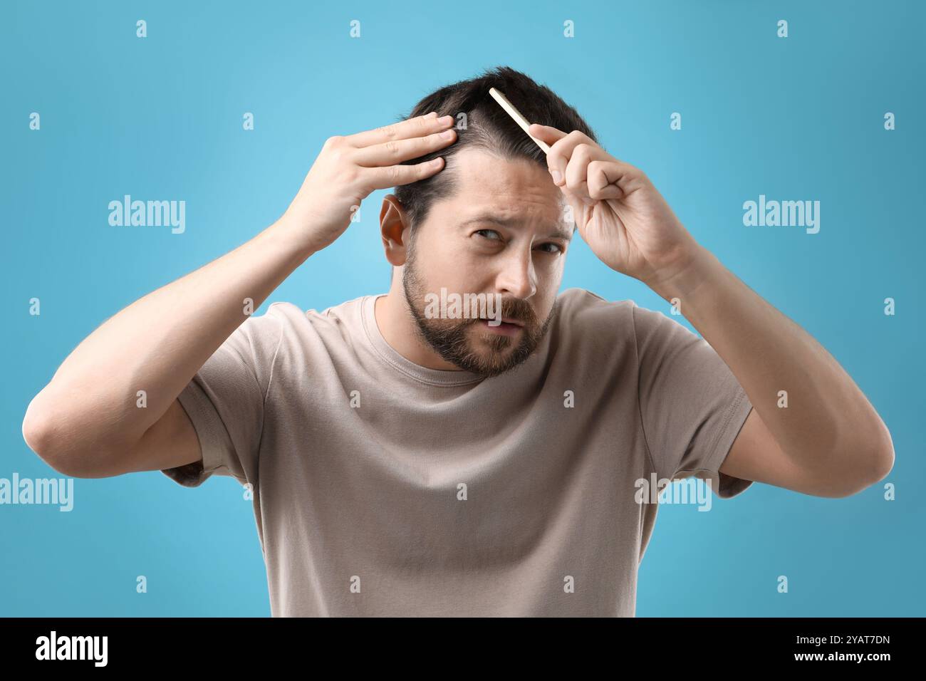 Man brushing his hair on light blue background. Alopecia problem Stock ...