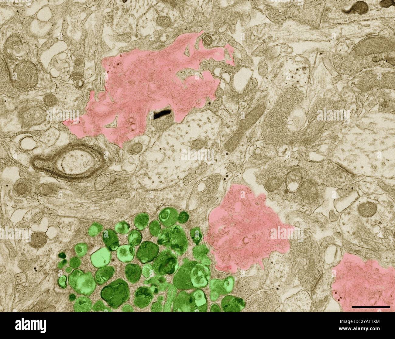 Coloured transmission electron micrograph (TEM) of a section through ...