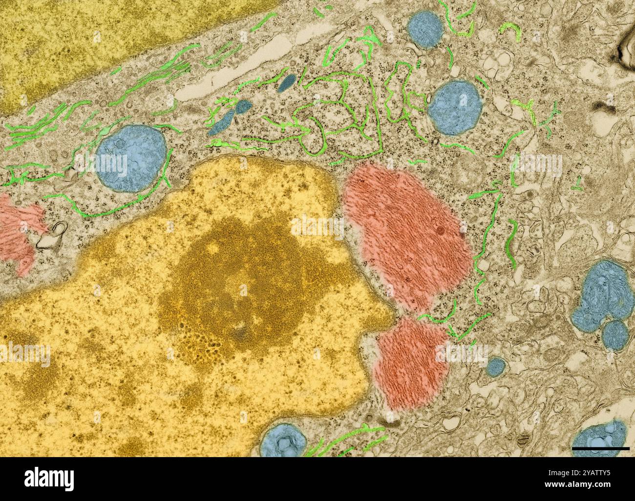 Neuron in Alzheimer's disease, coloured transmission electron ...