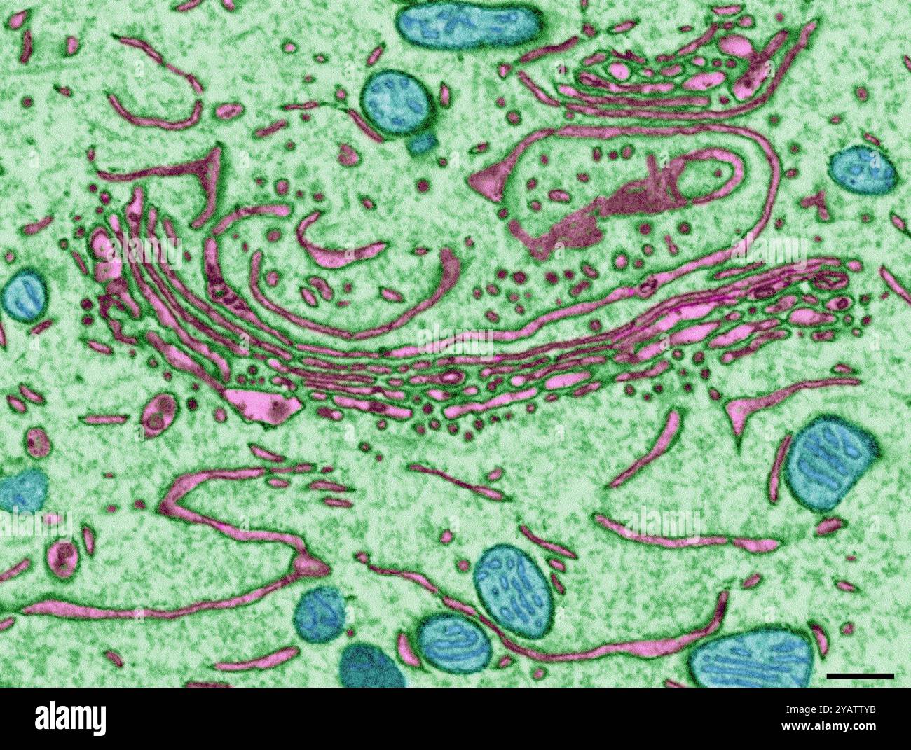 Coloured transmission electron micrograph (TEM) of a section through a ...