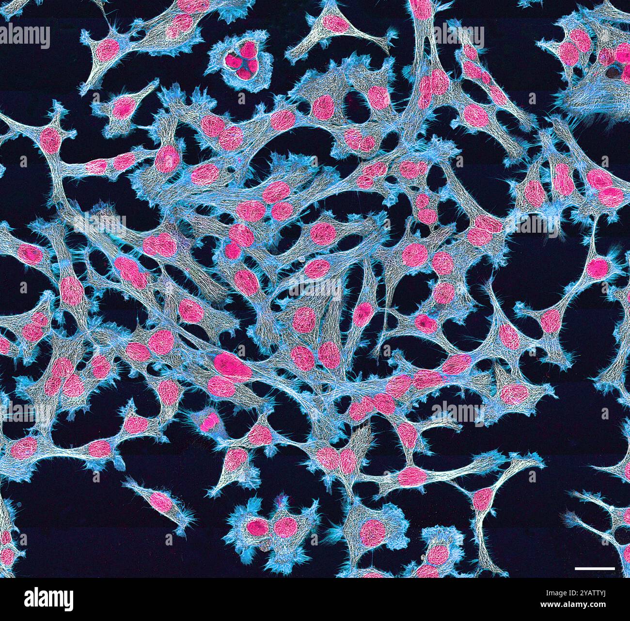 HeLa cells, fluorescence light micrograph Stock Photo - Alamy