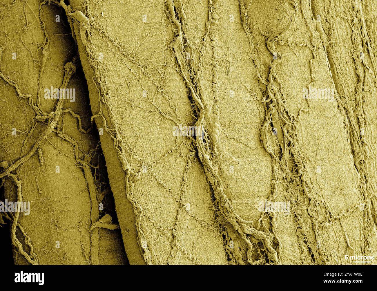 Coloured scanning electron micrograph (SEM) of skeletal, or striated, muscle fibres. Each fibre ...