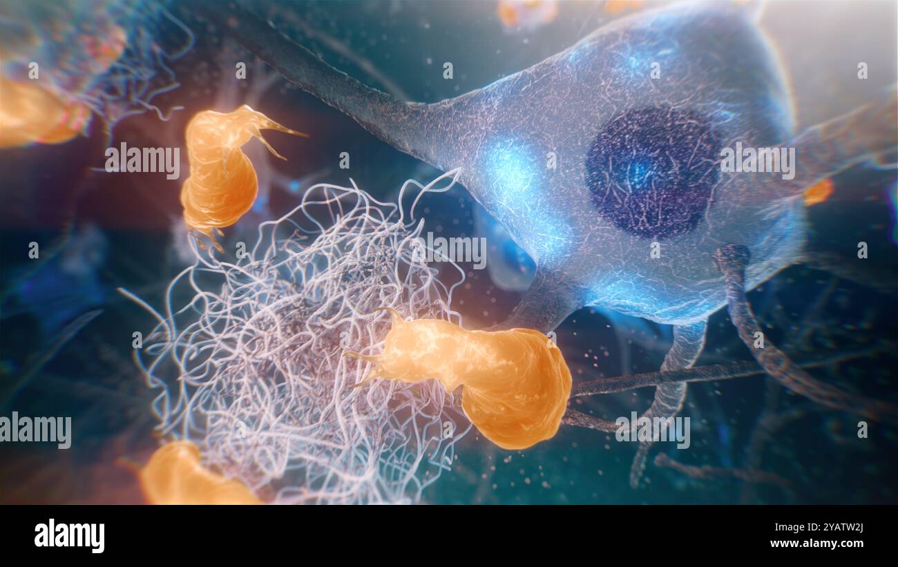 Illustration of activated and proliferating microglia (orange) in ...