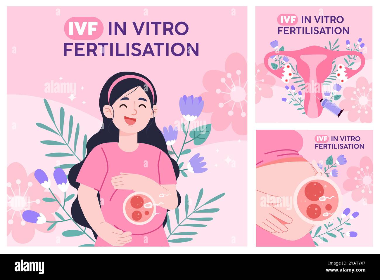 In vitro fertilization process with woman and embryo. Vector ...