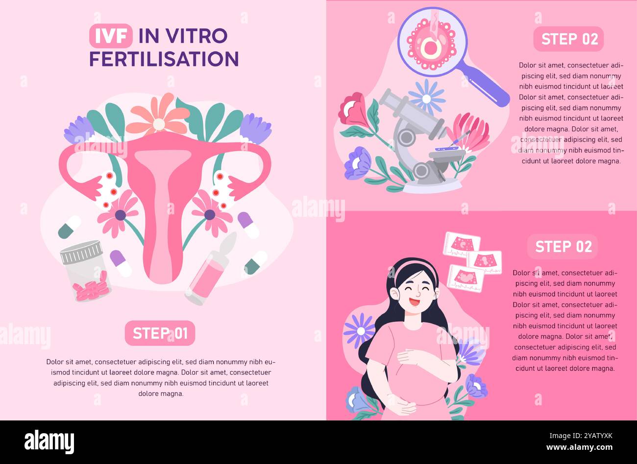 IVF Treatment Steps with In Vitro Fertilization Concept. Vector ...