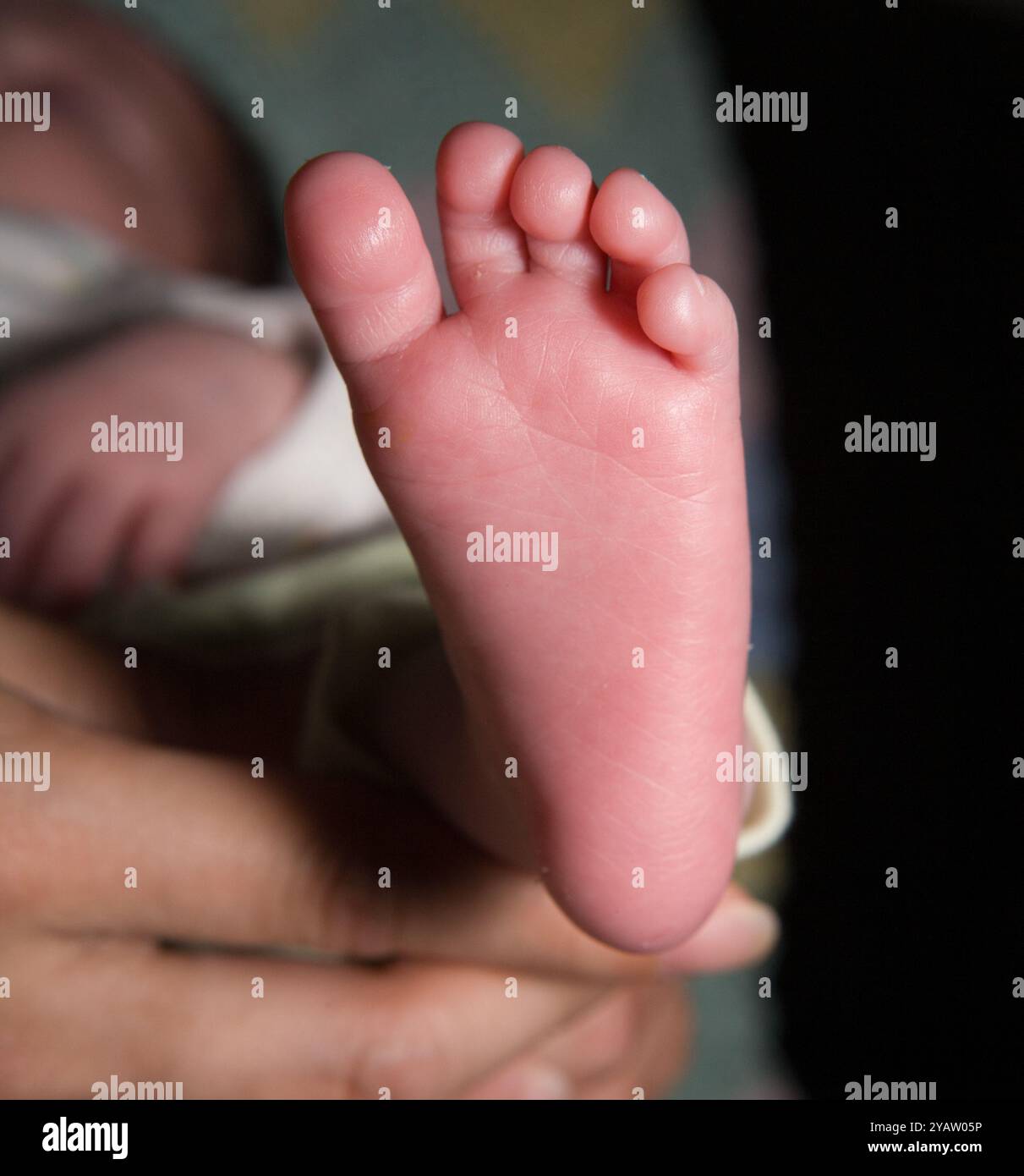 Whorl and ridge patterns on a baby's foot. Like fingerprints and hand ...