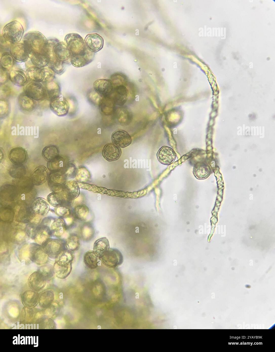 (Trichia varia) Protozoa Stock Photo - Alamy