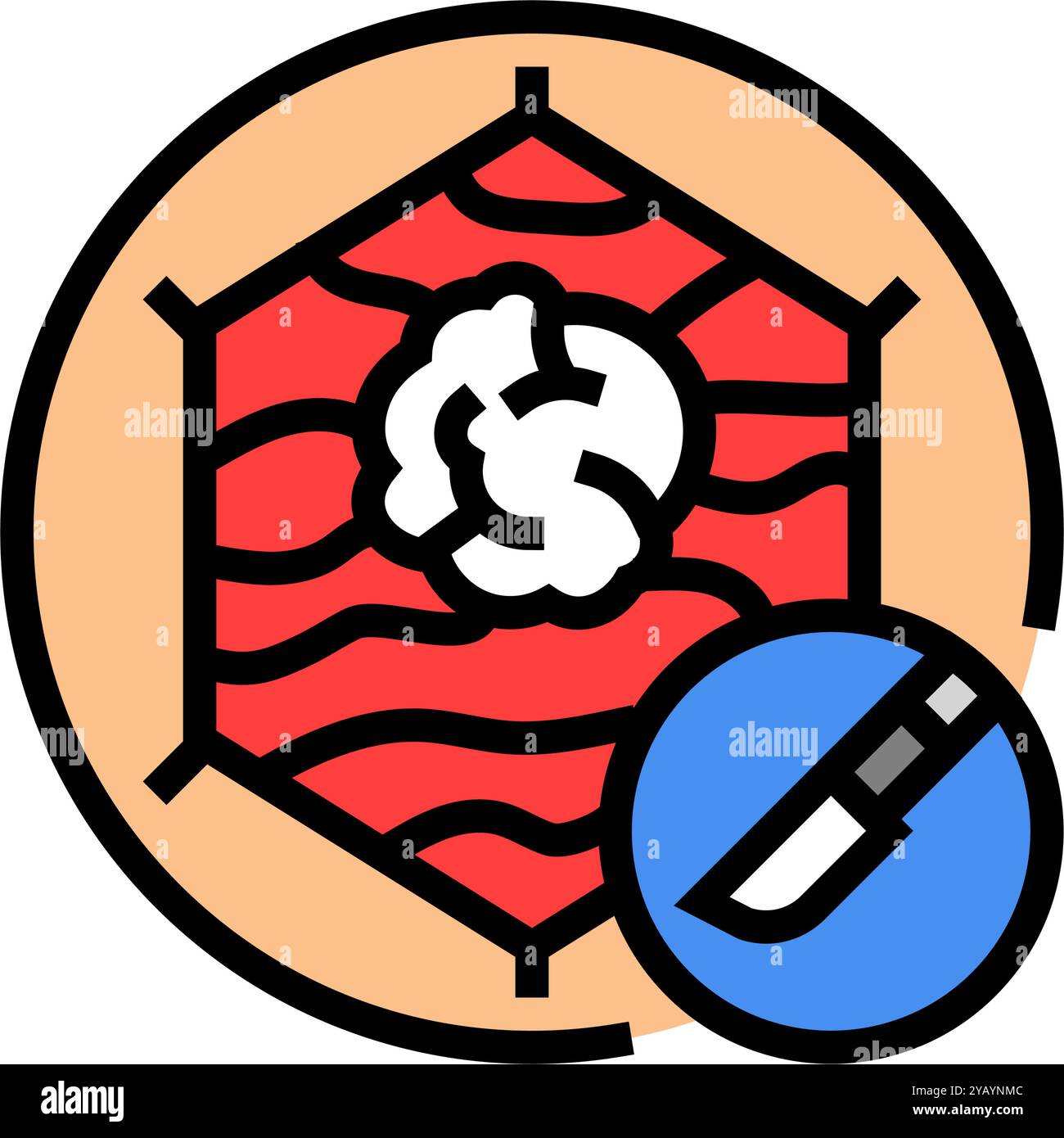 tumor removal cancer treatment color icon vector illustration Stock ...