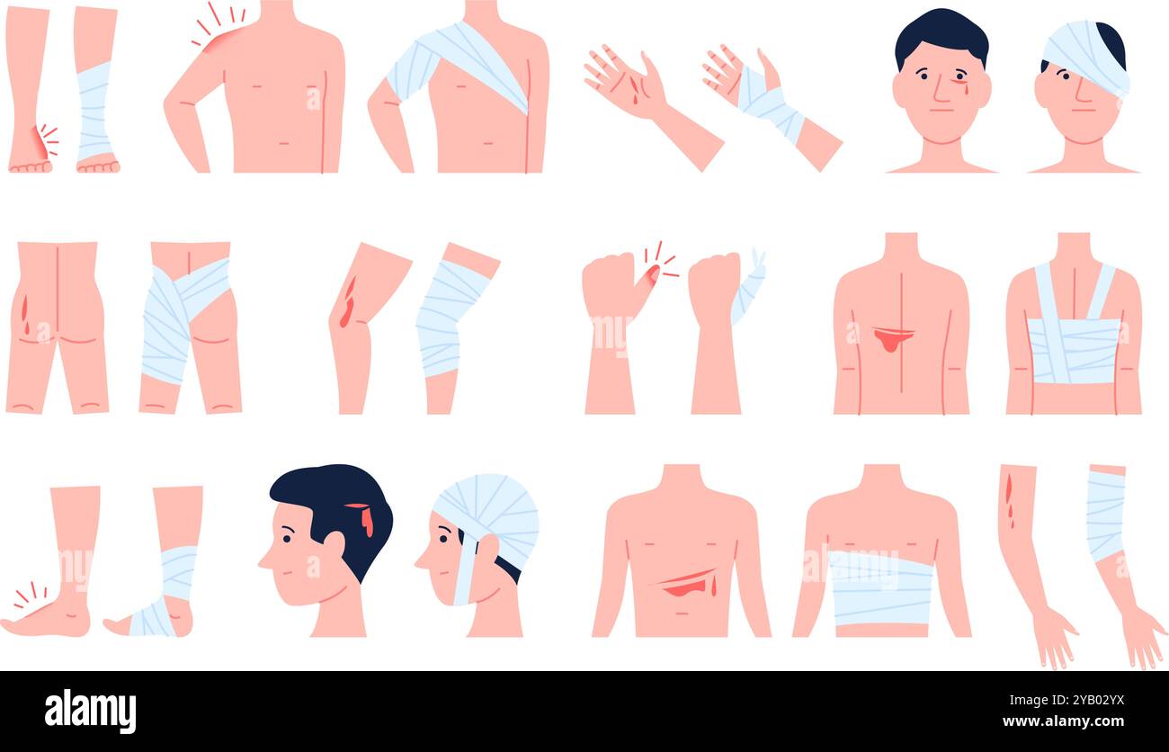 Bandaged body parts. Bandage application to injury, wound or bruise ...