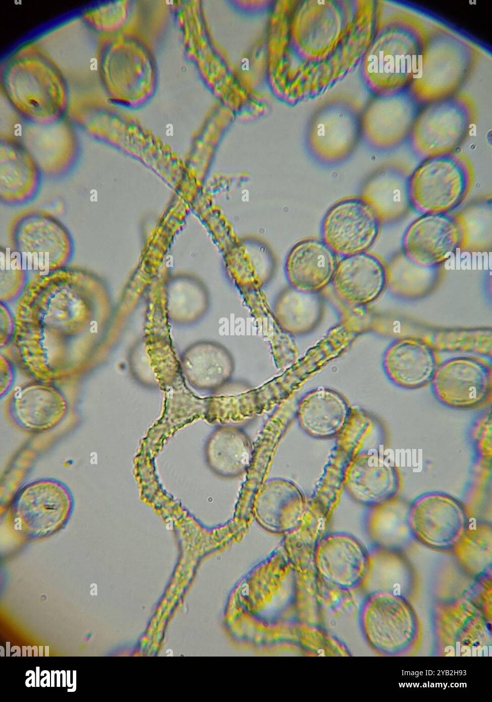 golden apple slime mold (Arcyria pomiformis) Protozoa Stock Photo - Alamy