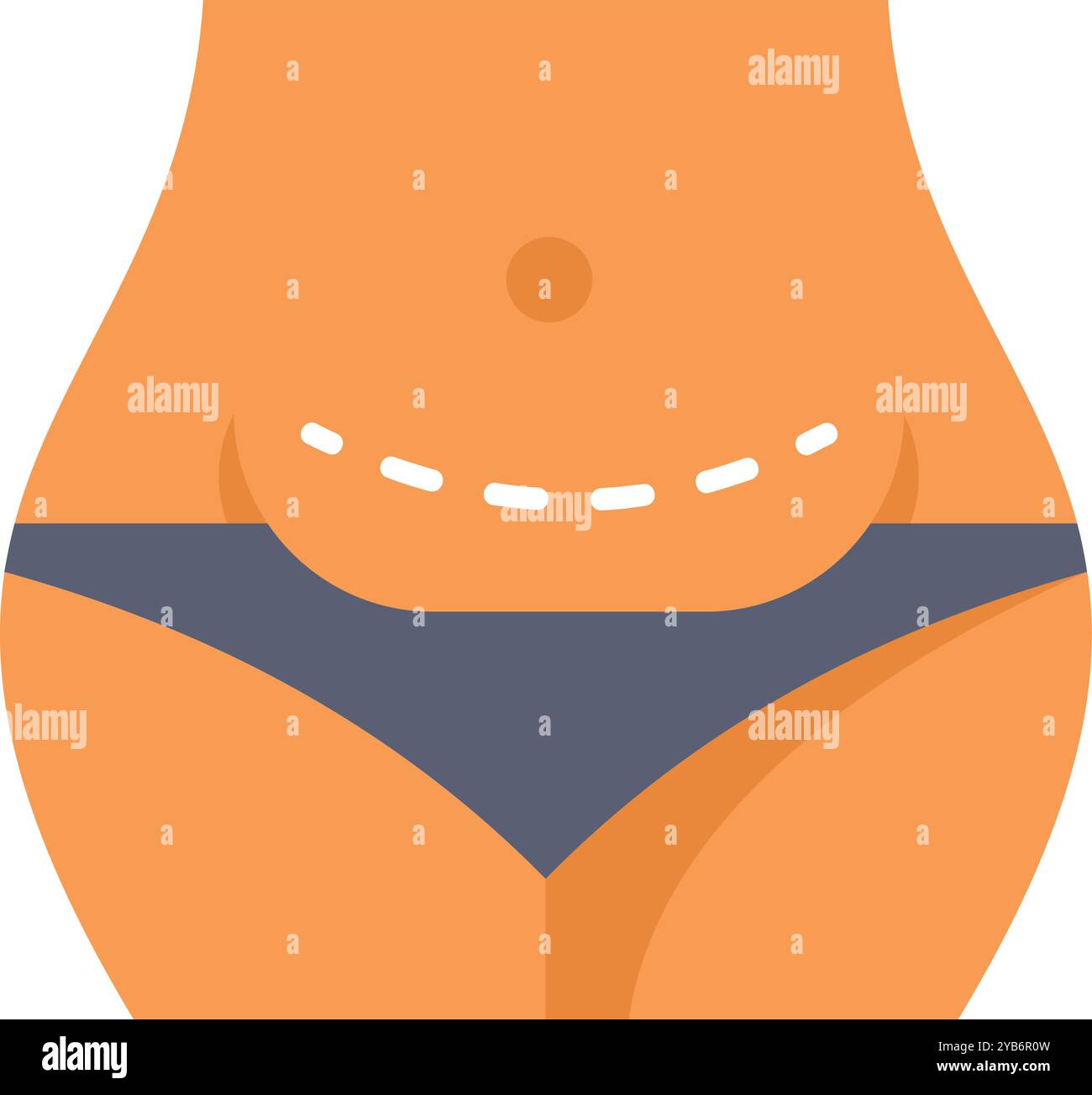 Belly after c section Stock Vector Images - Alamy