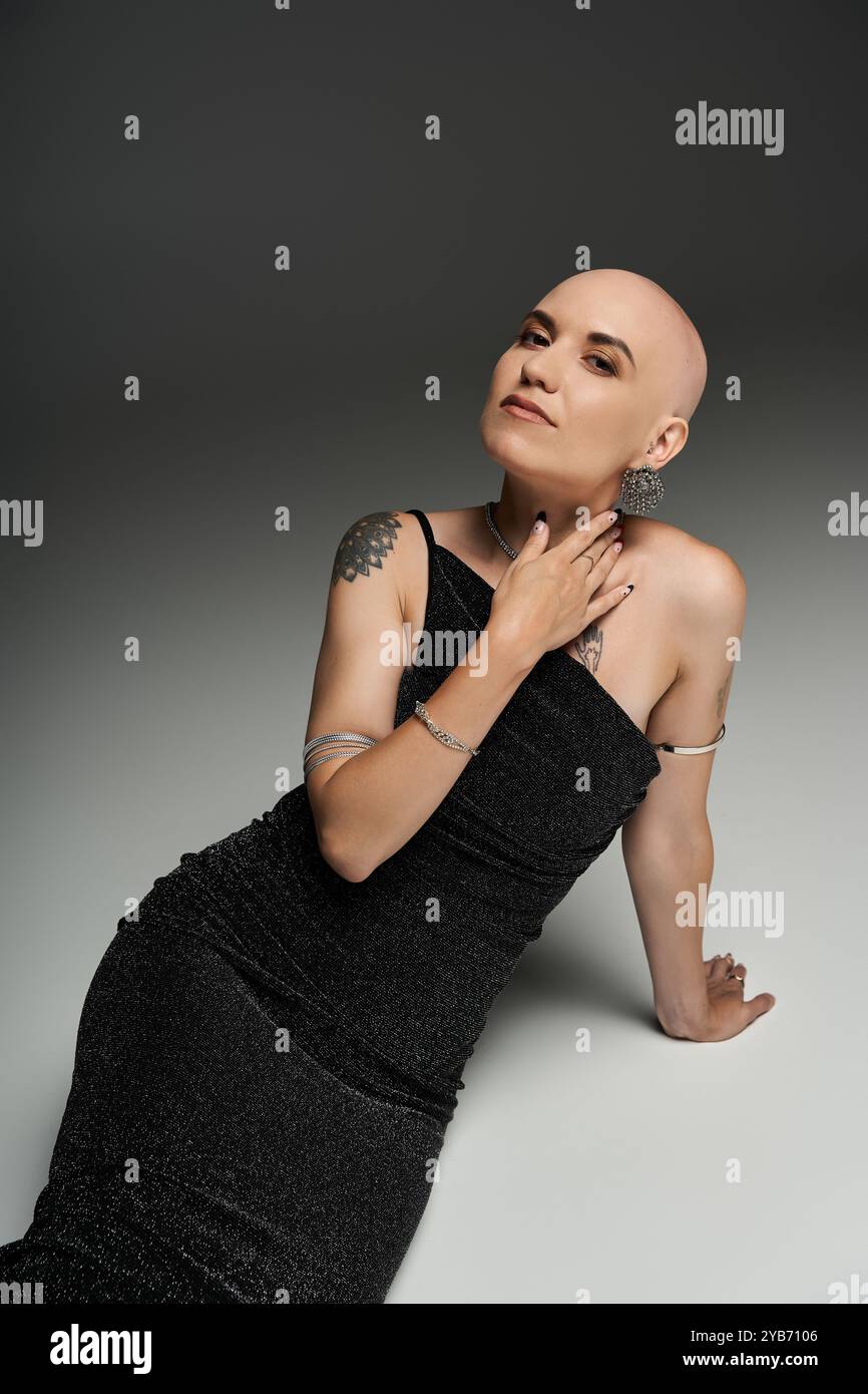 A bald woman with alopecia poses elegantly, highlighting her strength ...