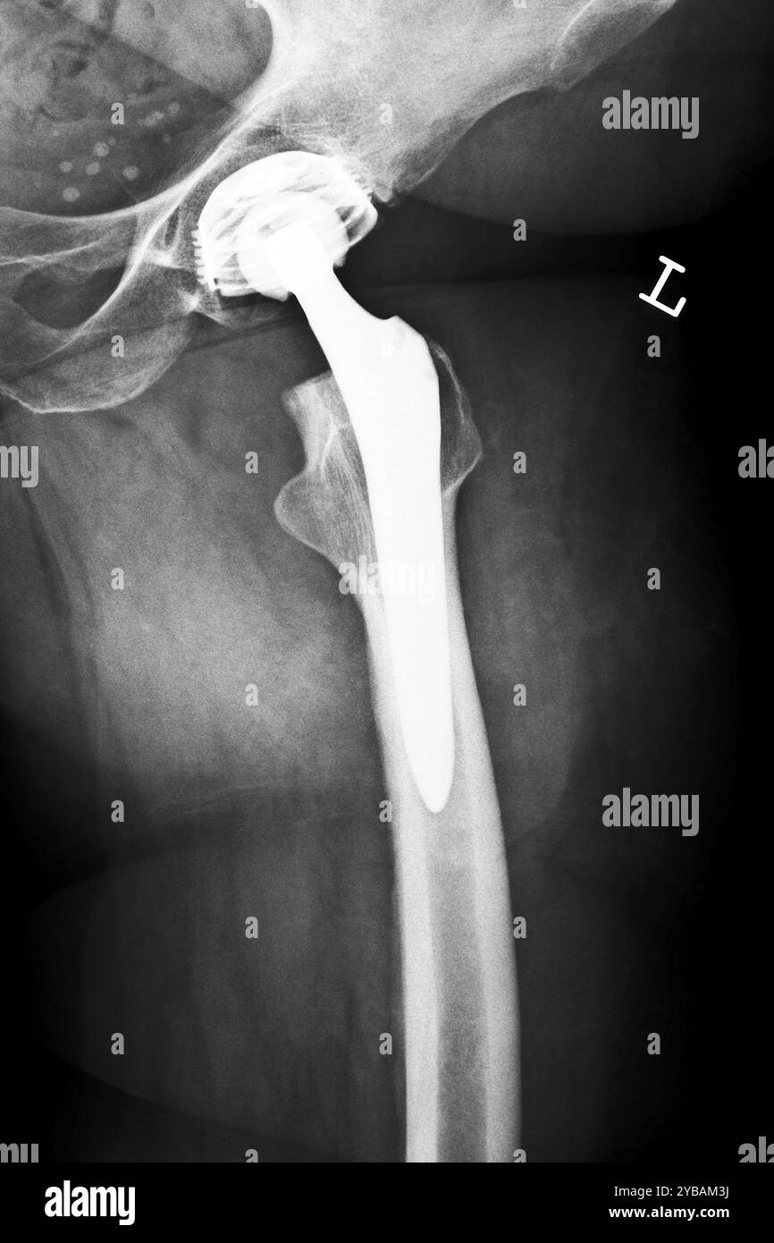 Post operative Black and White Stock Photos & Images - Alamy