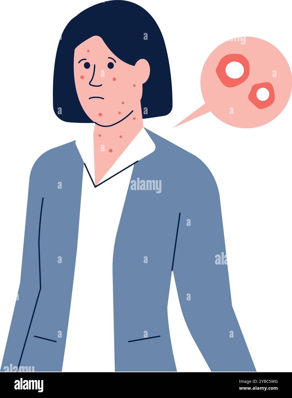 A woman with a red rash on her neck Stock Vector Image & Art - Alamy