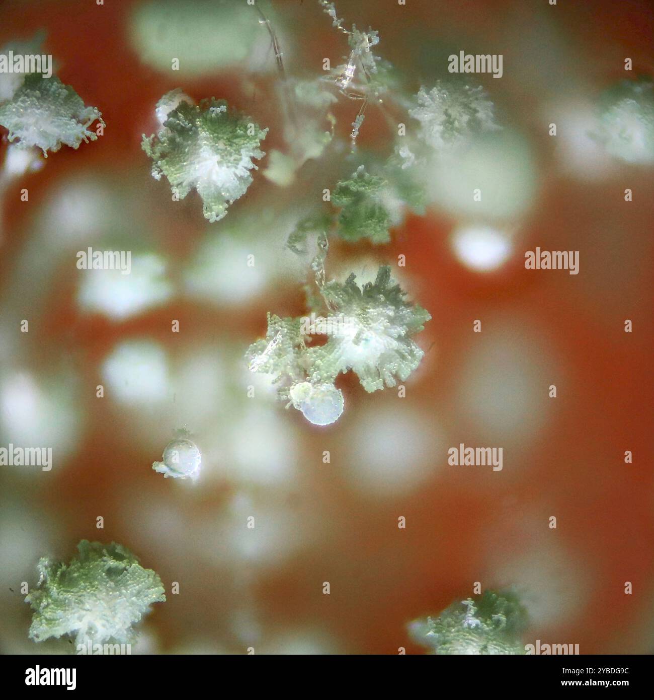 Aspergillus spore heads in reflected light microscopy, showing ...