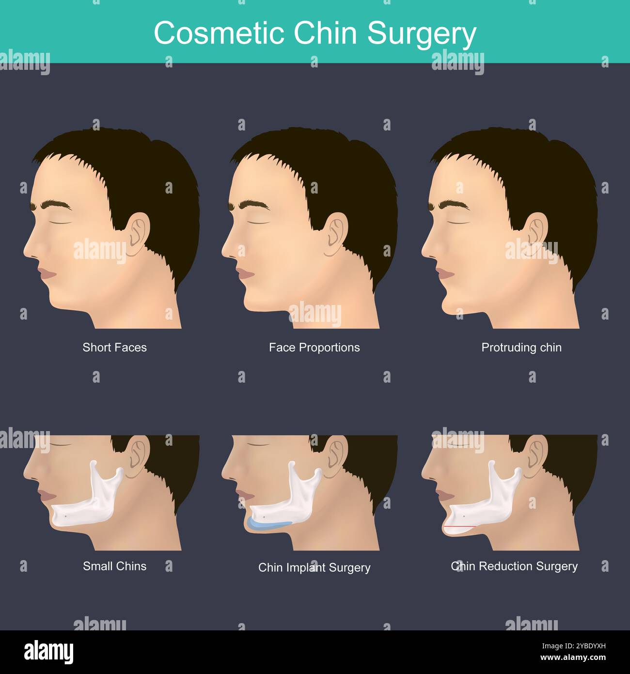 Weak chin hi-res stock photography and images - Alamy