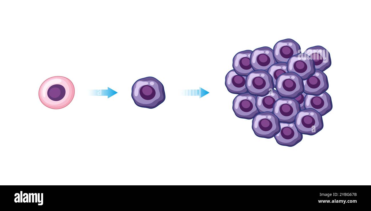 Cancer development, illustration Stock Photo - Alamy