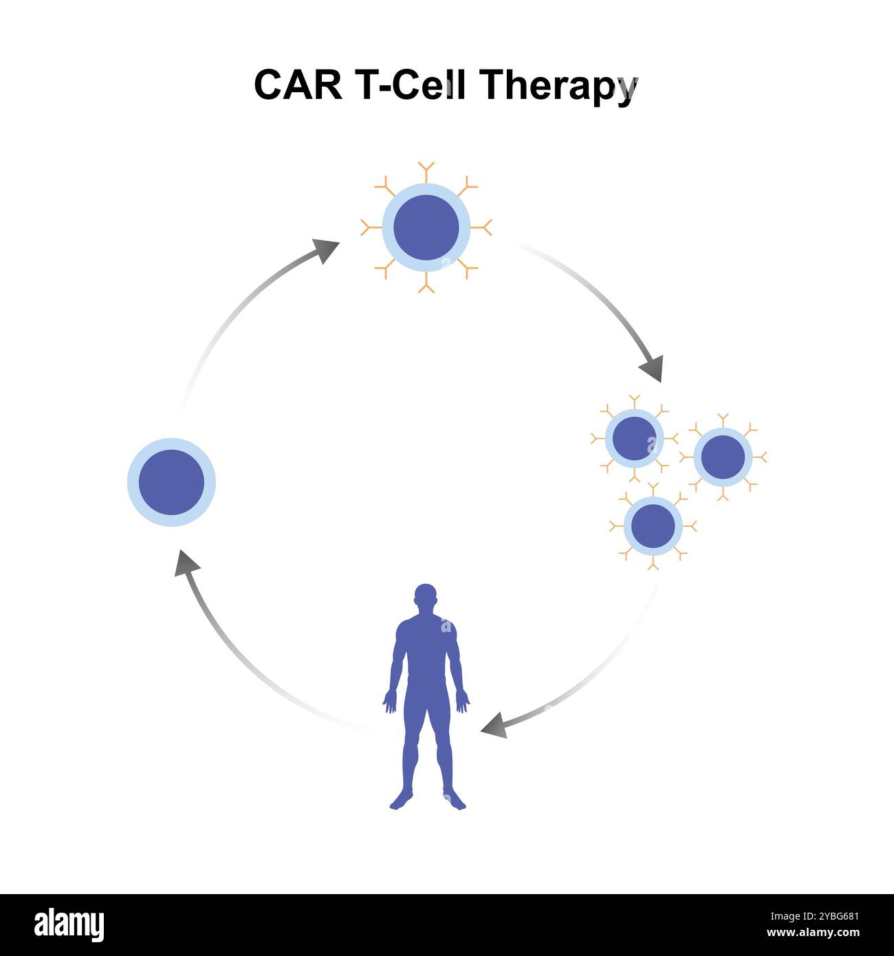 CAR-T cell therapy, illustration Stock Photo - Alamy