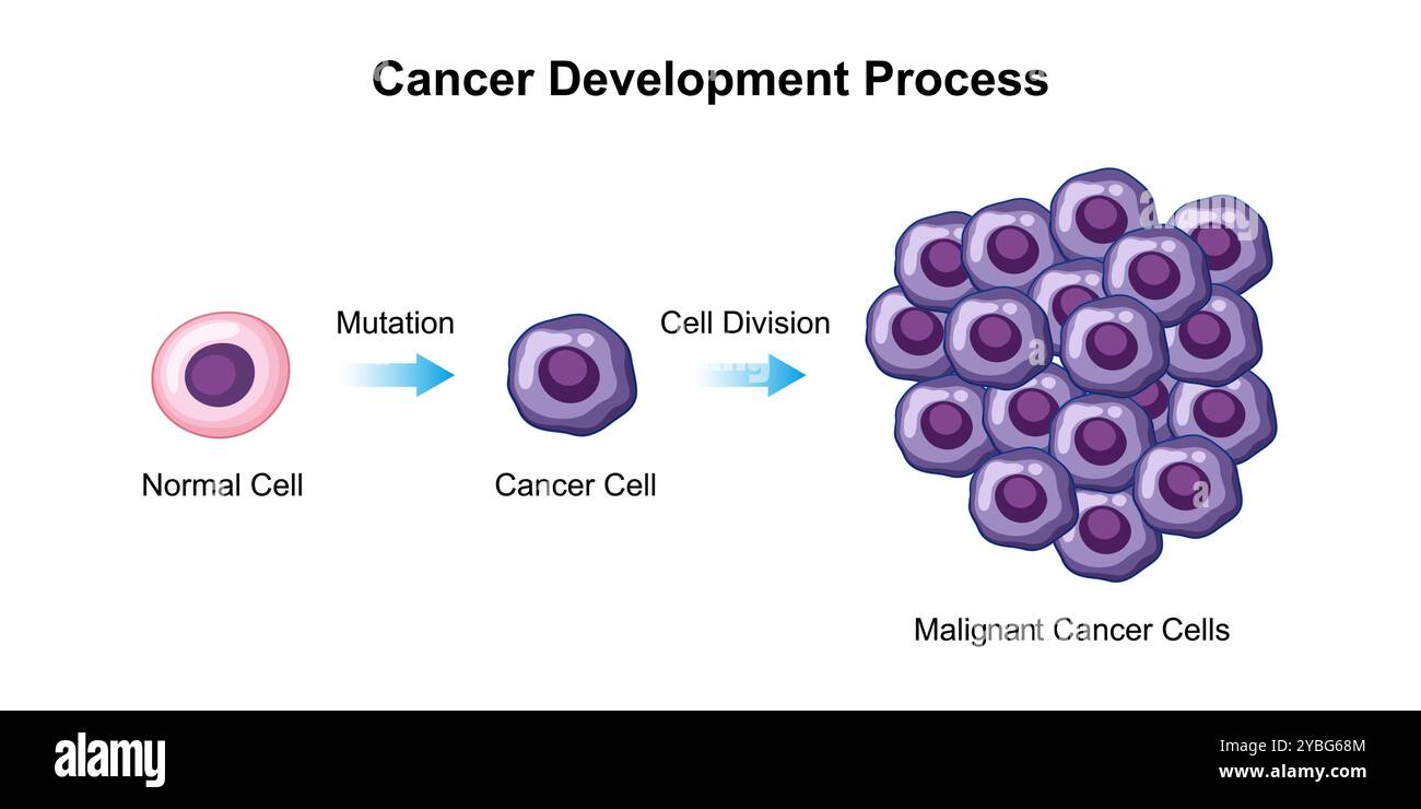 Cancer development, illustration Stock Photo - Alamy
