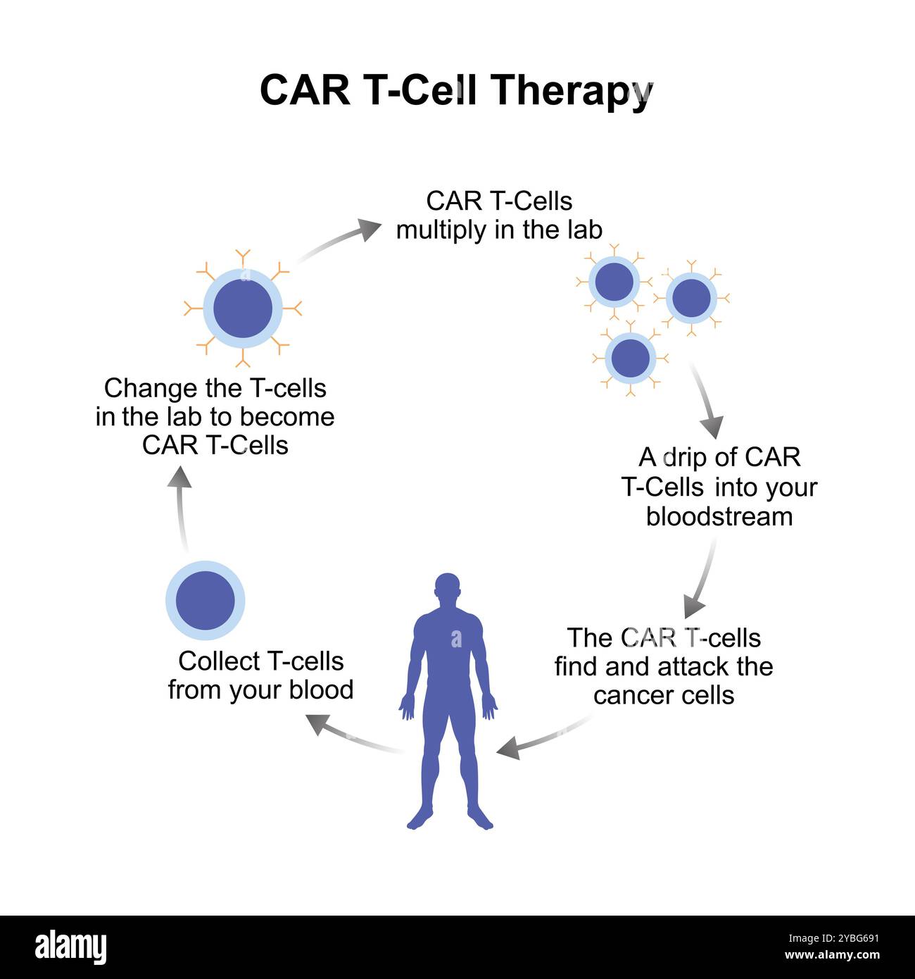 CAR-T cell therapy, illustration Stock Photo - Alamy