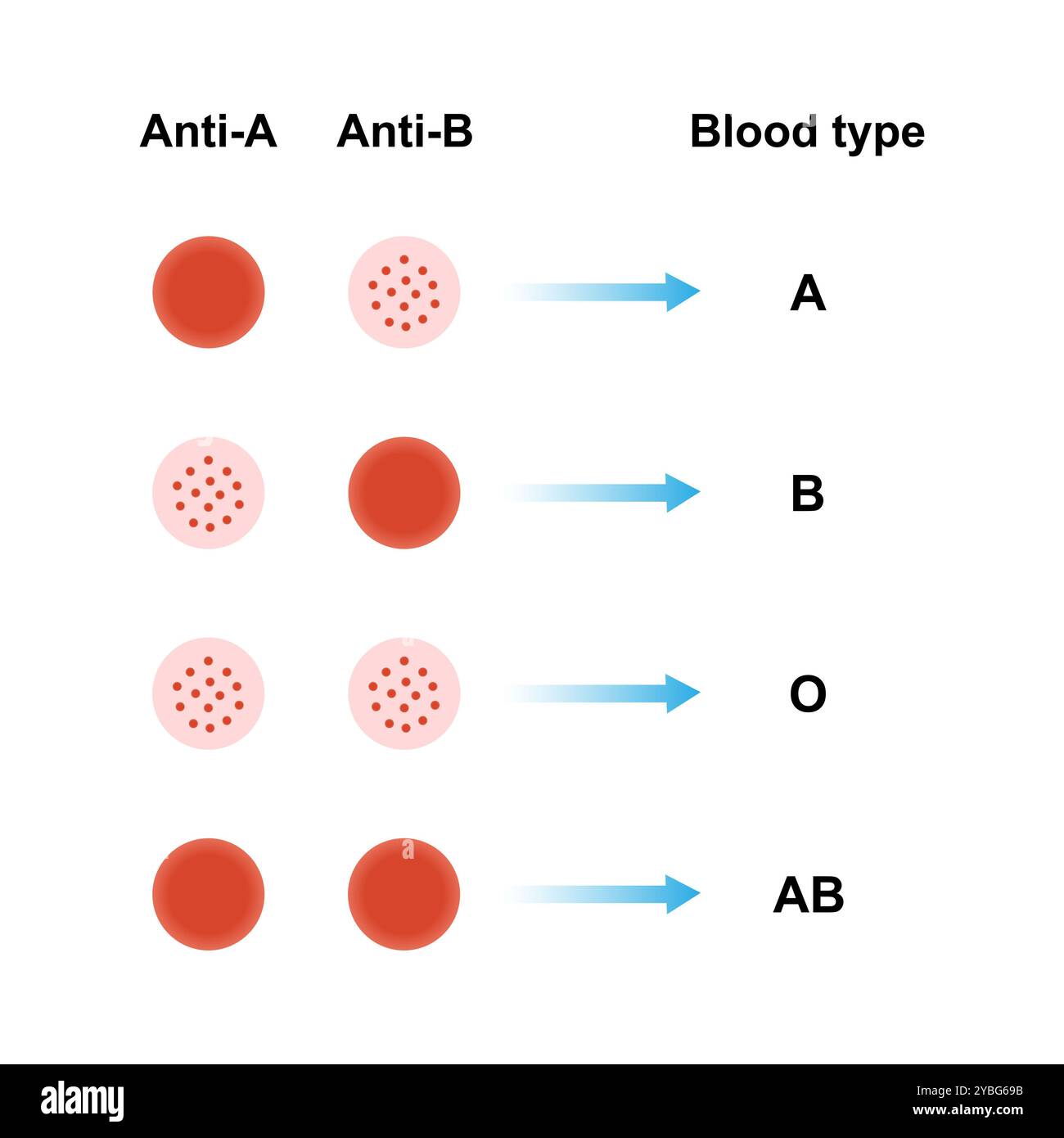 Blood a typing hi-res stock photography and images - Alamy