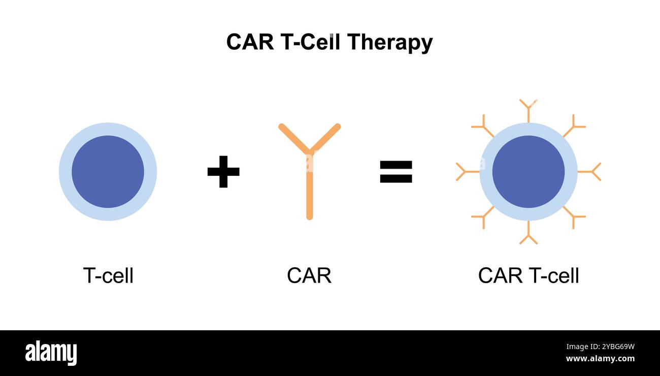 CAR-T cell therapy, illustration Stock Photo - Alamy