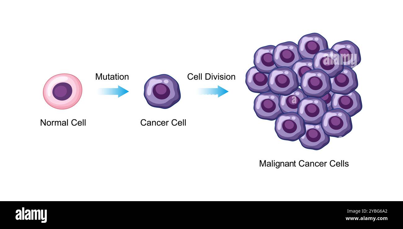 Cancer development, illustration Stock Photo - Alamy