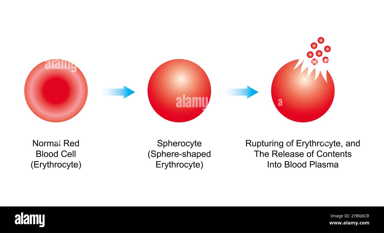 Hemolysation Cut Out Stock Images & Pictures - Alamy