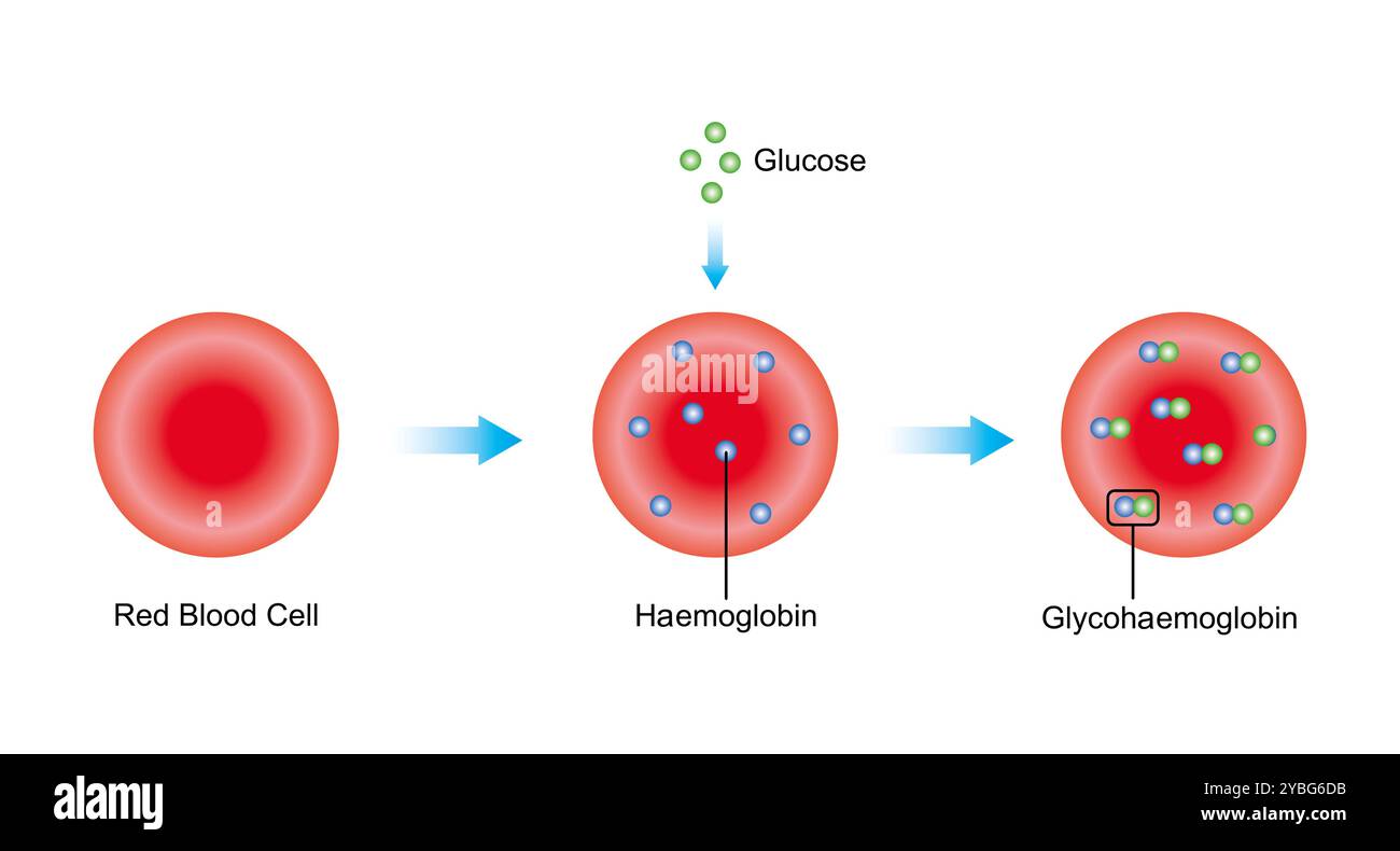 Glycated haemoglobin, illustration Stock Photo - Alamy
