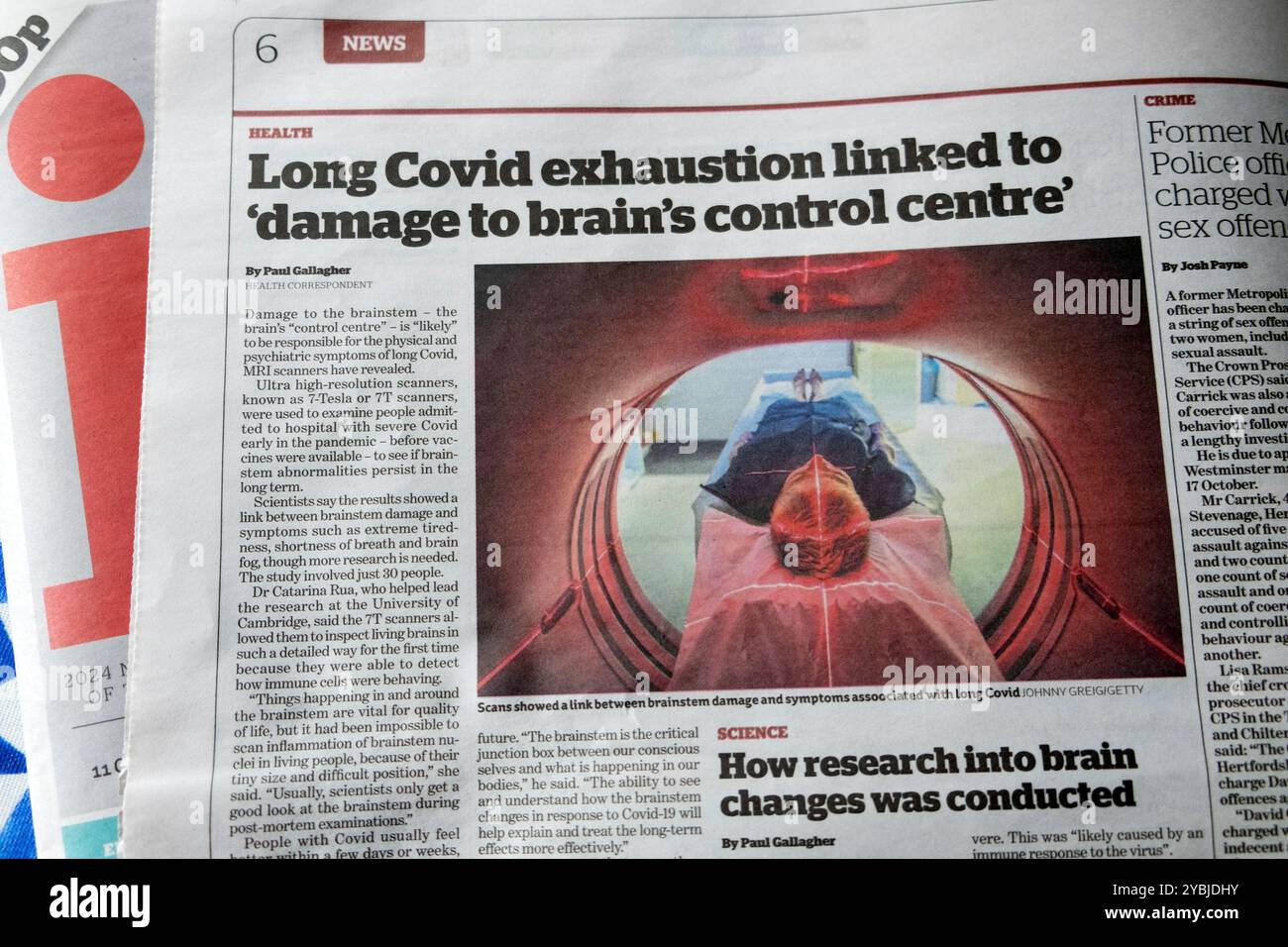 'Long Covid exhaustion linked to 'damage to brain's control centre' i ...