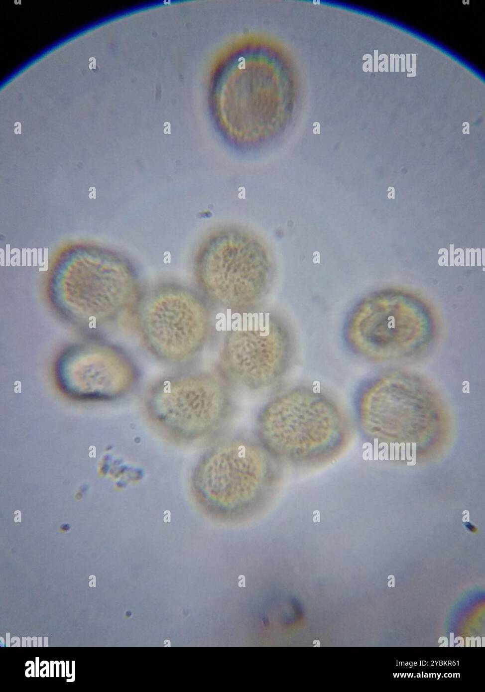 (Trichia erecta) Protozoa Stock Photo - Alamy