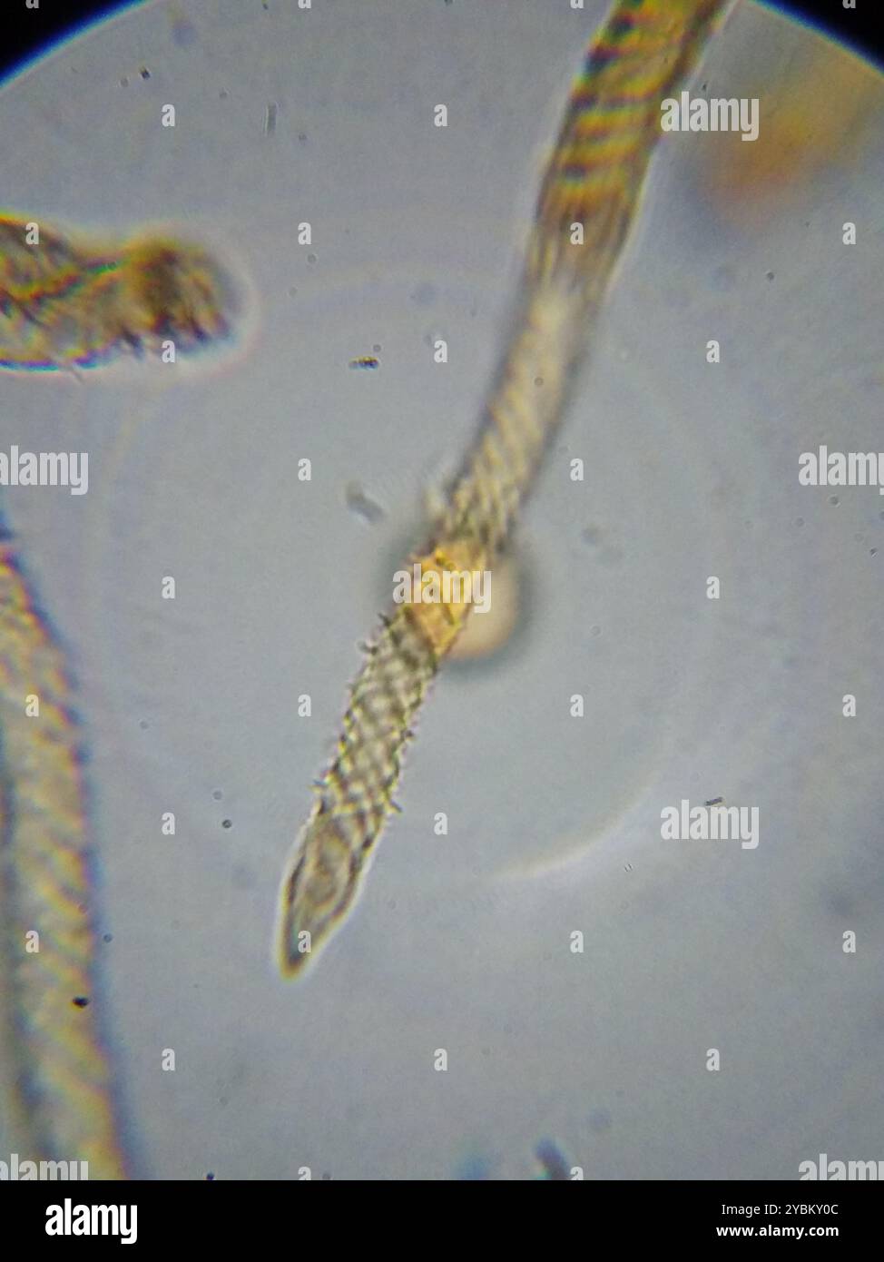 (Trichia erecta) Protozoa Stock Photo - Alamy