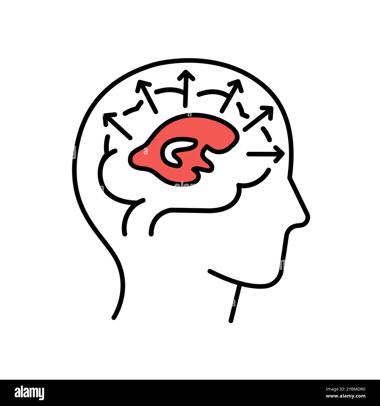 Hydrocephalus hi-res stock photography and images - Alamy