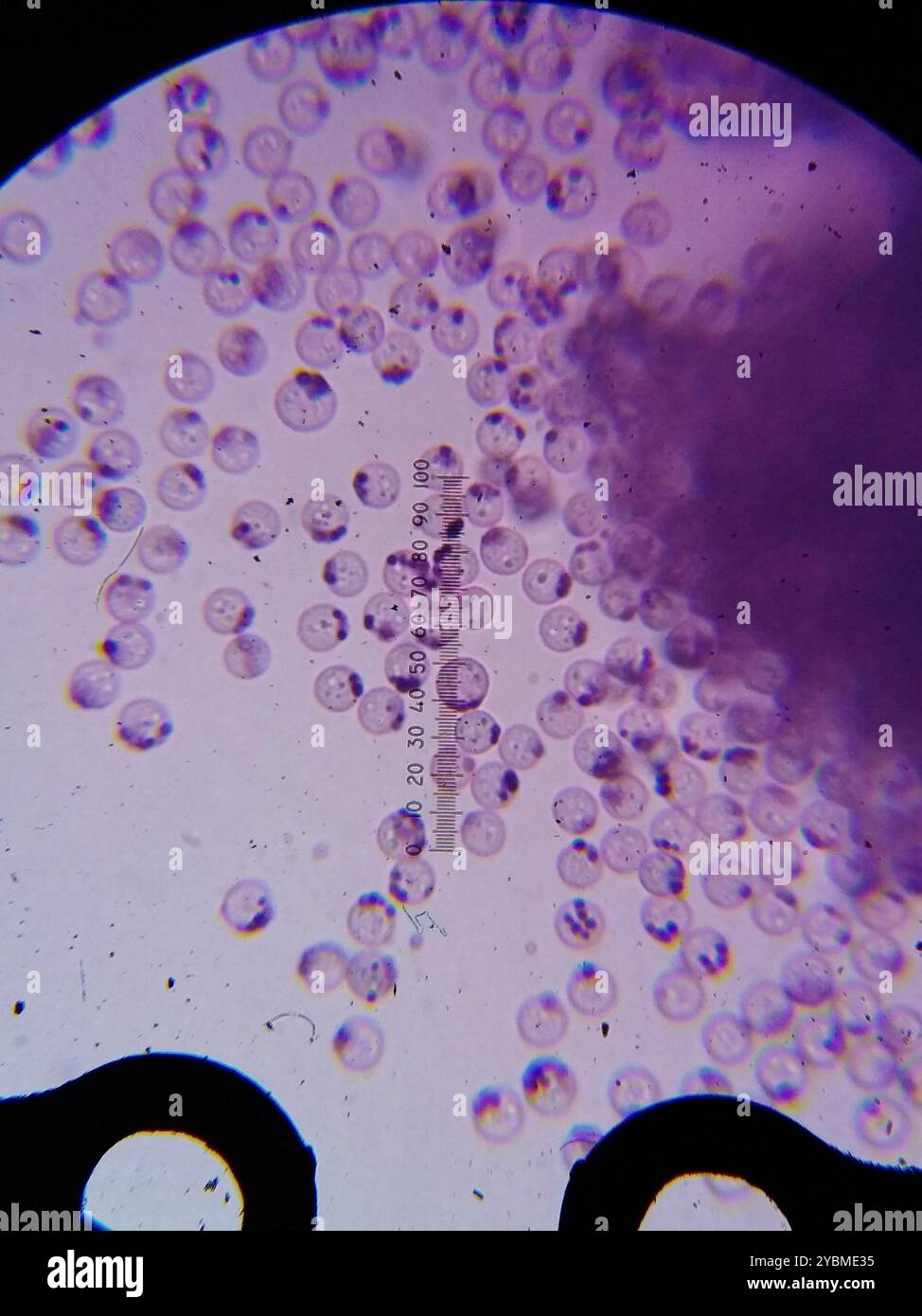 (Cribraria cancellata) Protozoa Stock Photo - Alamy