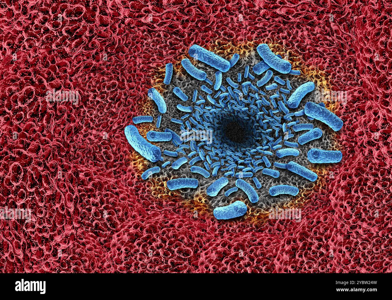Flesh Eating disease and life threatening Bacteria as flesh-eating ...
