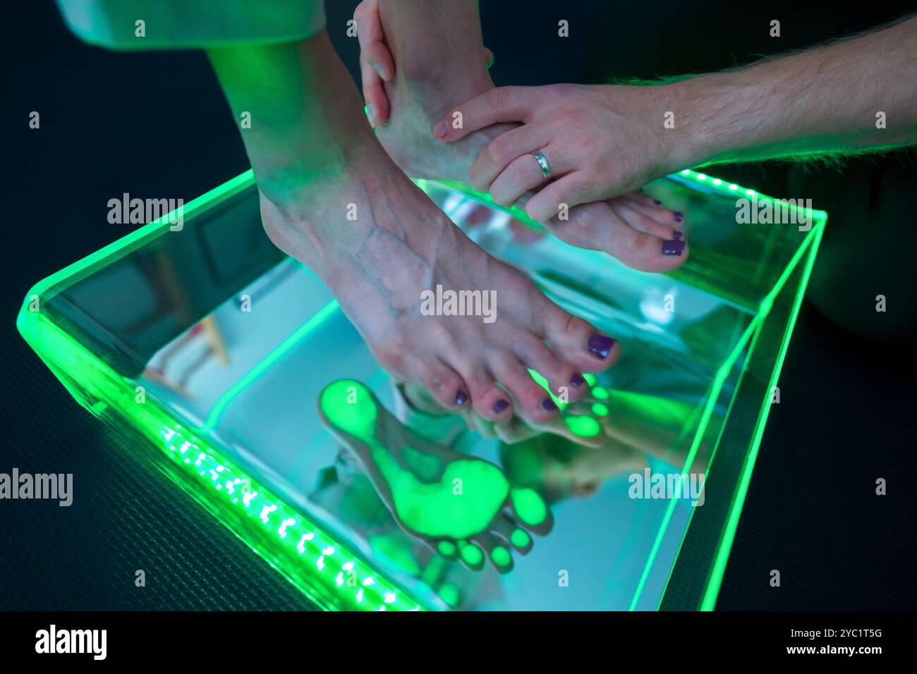 Pedobarography analysis shows the distribution of plantar pressure of ...