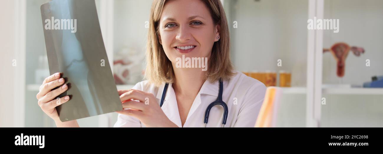 Positive female doctor holds X-ray image of joint of patient Stock ...