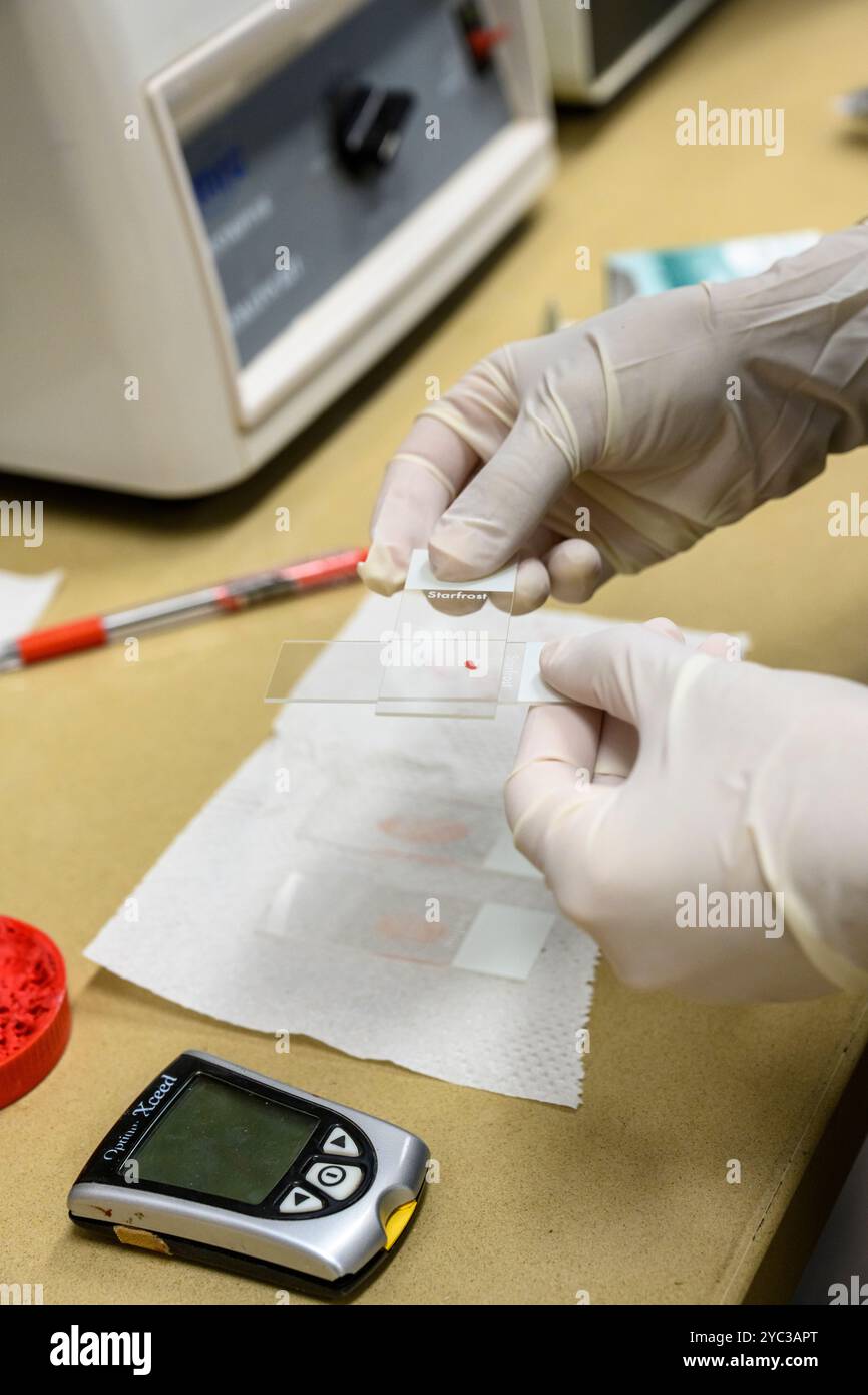 preparing a slide with a blood sample for examination, the blood on the ...