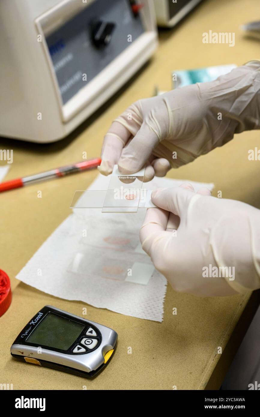 preparing a slide with a blood sample for examination, the blood on the ...