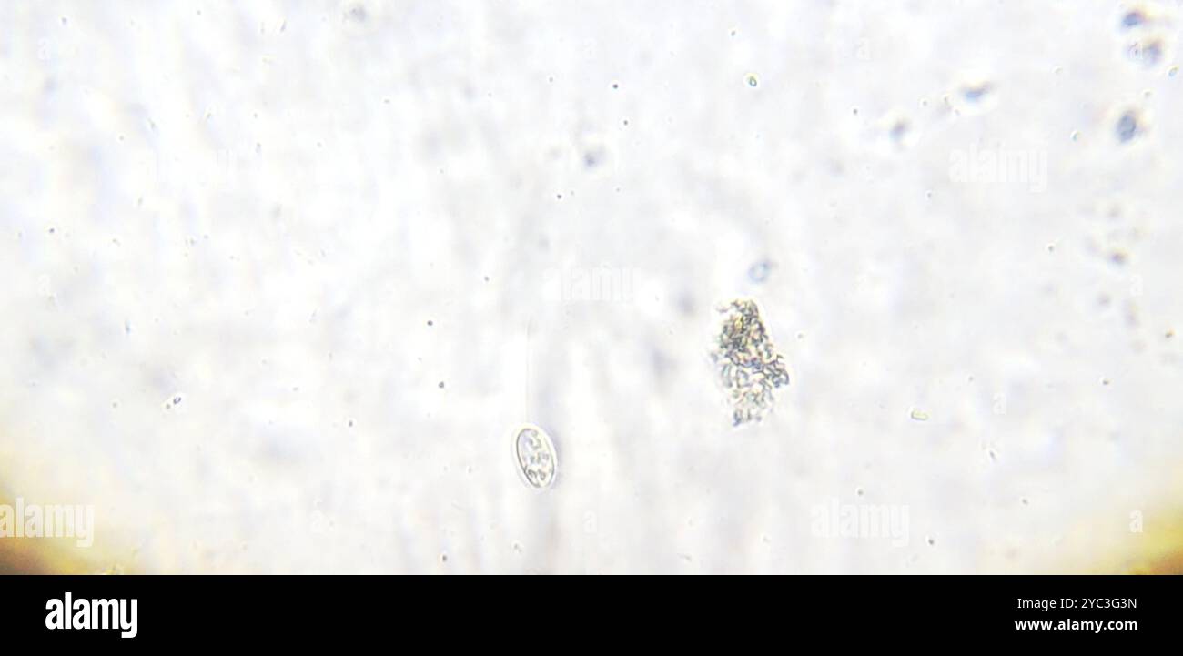 euglenids (Euglenida) Protozoa Stock Photo - Alamy