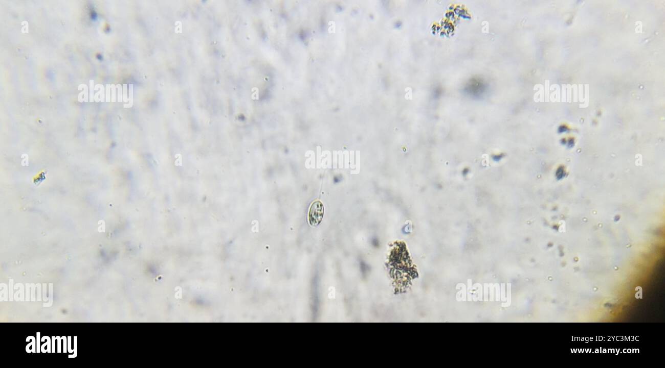euglenids (Euglenida) Protozoa Stock Photo - Alamy