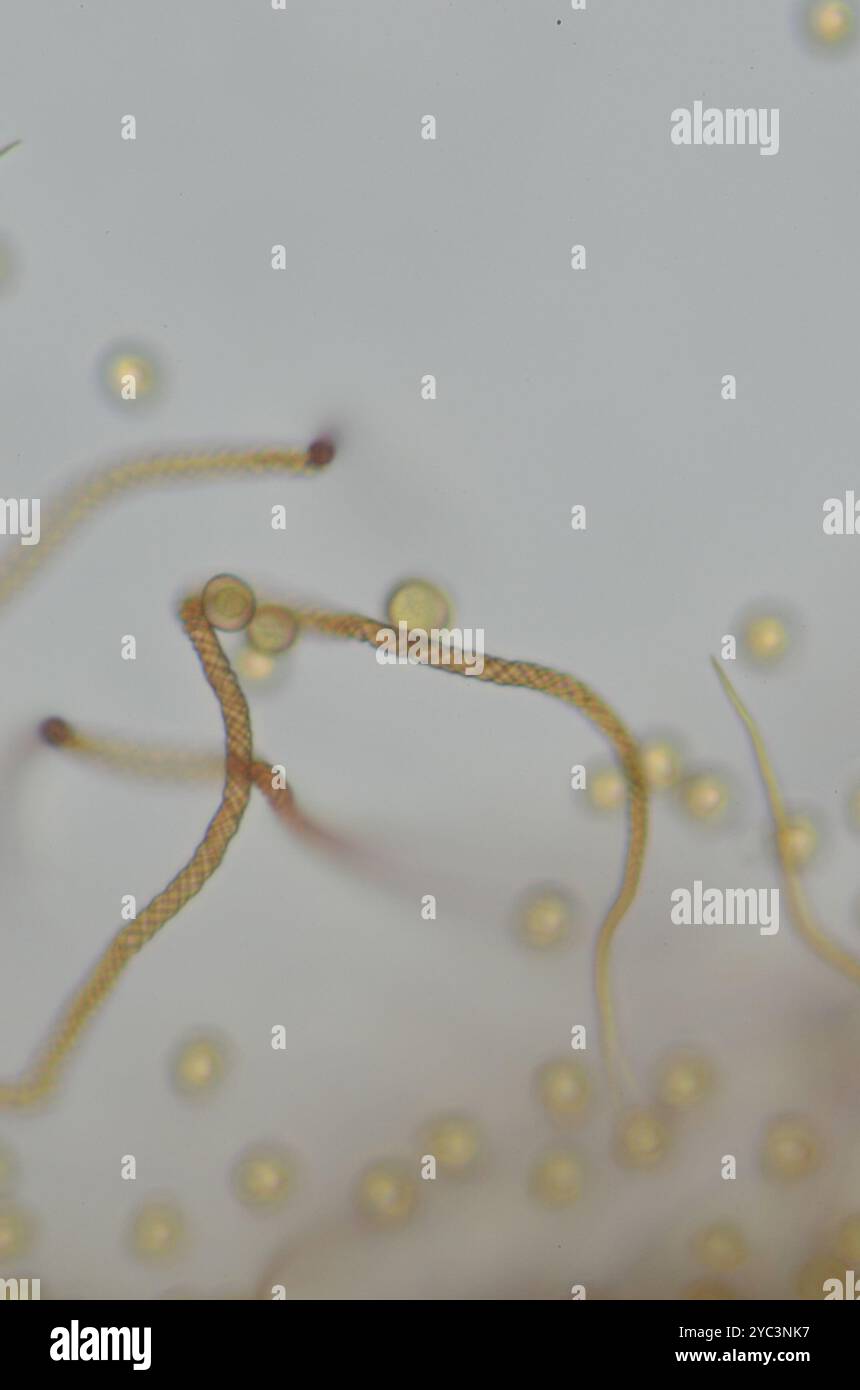 (Trichia botrytis) Protozoa Stock Photo - Alamy