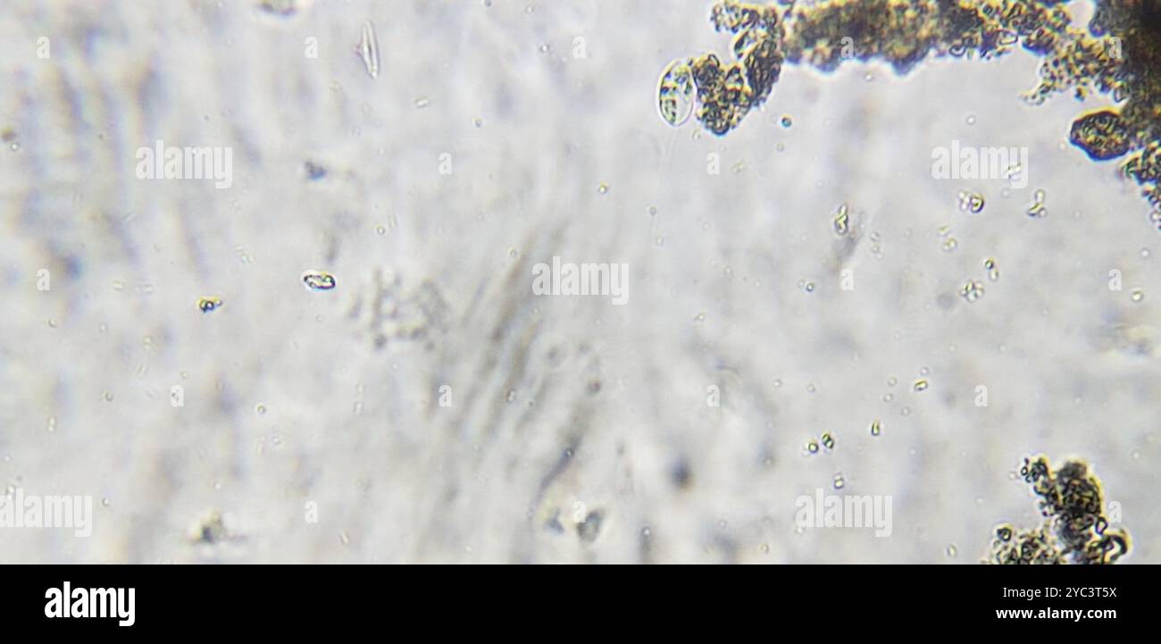 euglenids (Euglenida) Protozoa Stock Photo - Alamy