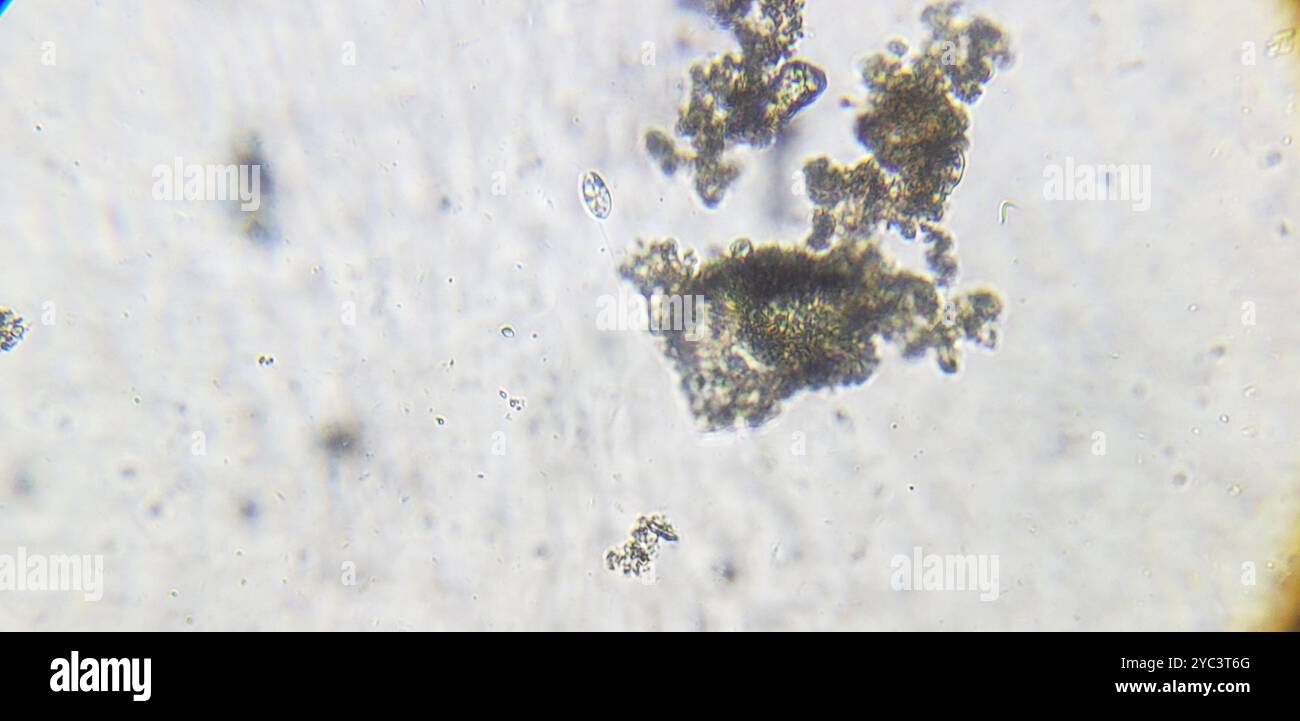 euglenids (Euglenida) Protozoa Stock Photo - Alamy