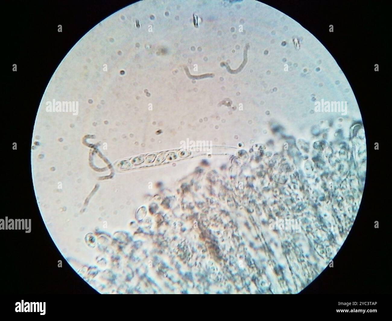 Beech jelly disc hi-res stock photography and images - Alamy