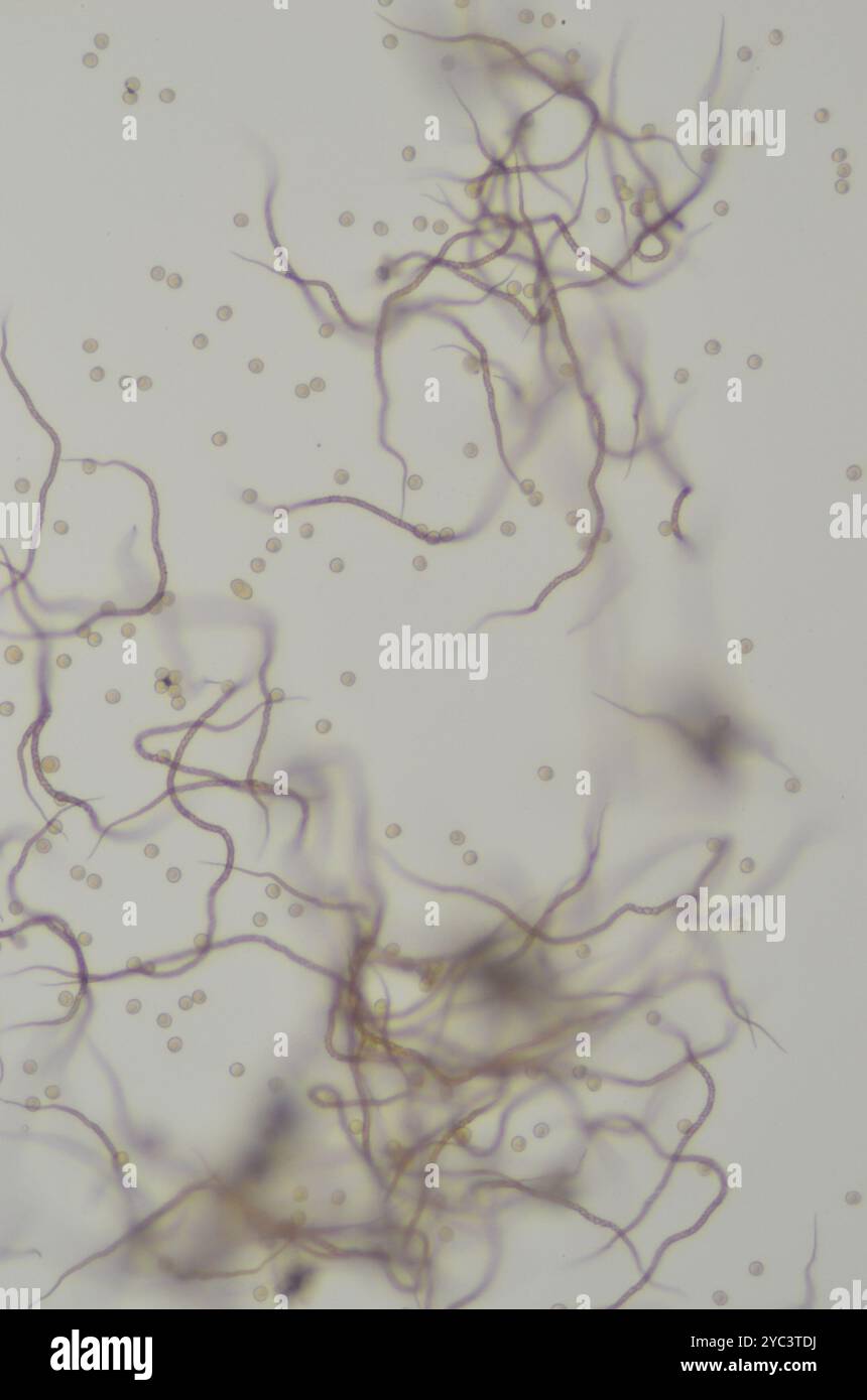 (Trichia botrytis) Protozoa Stock Photo - Alamy