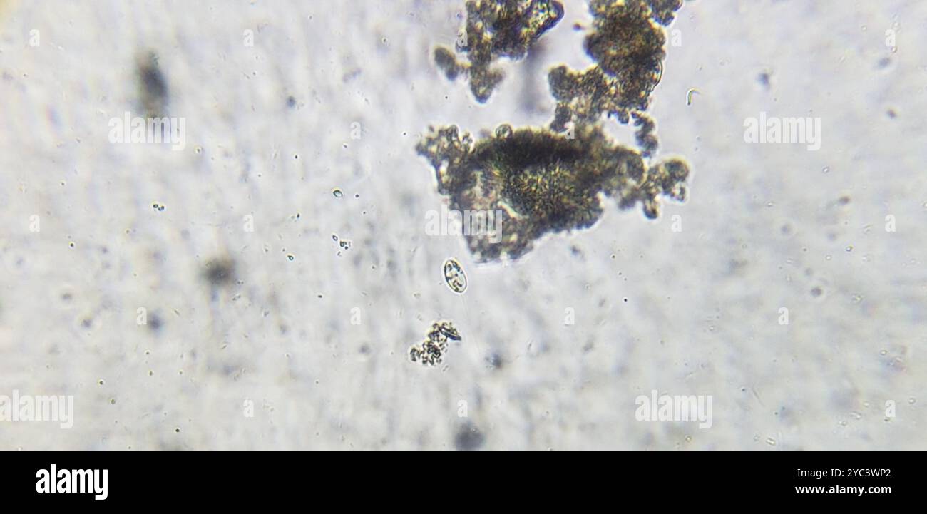 euglenids (Euglenida) Protozoa Stock Photo - Alamy